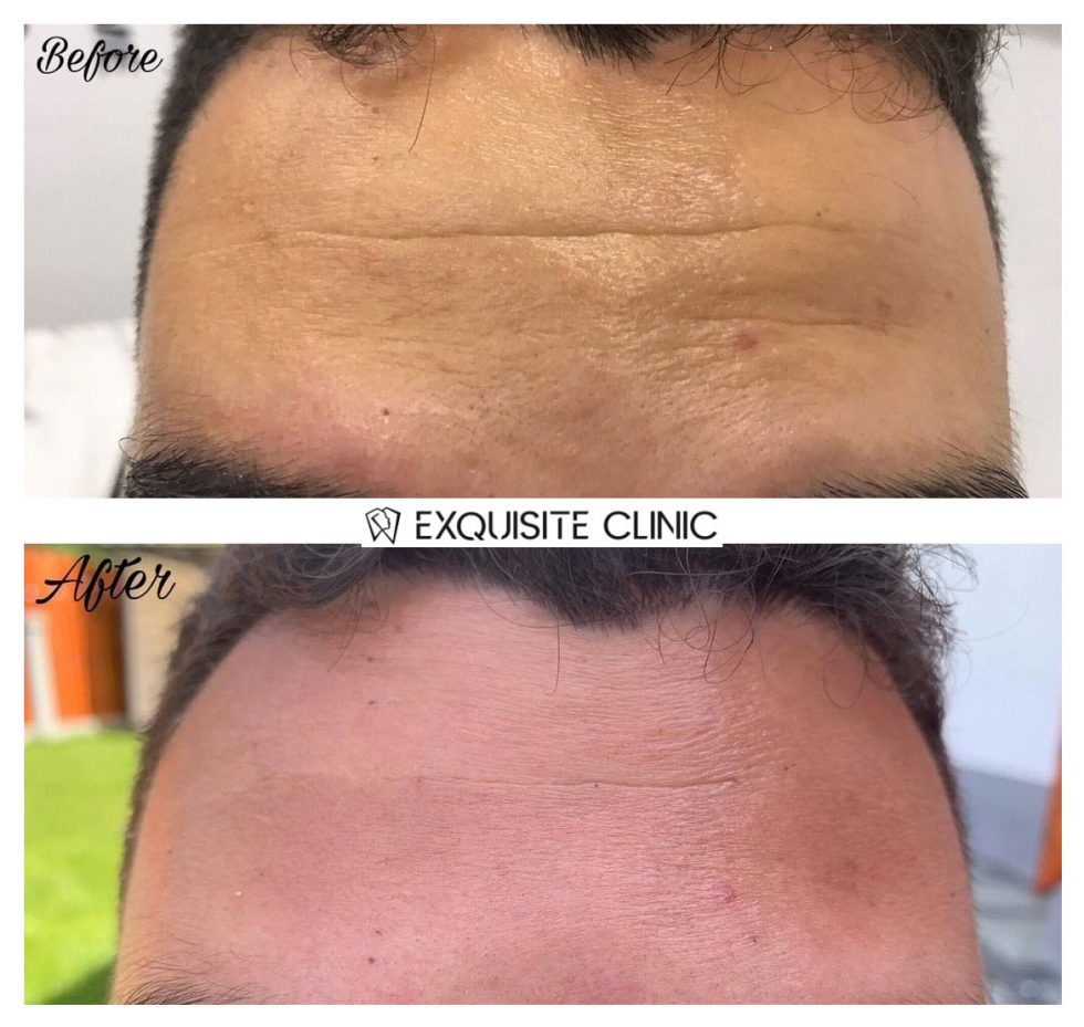 Clinica Stomatologica Cluj-Napoca - Manastur | EXQ Clinic