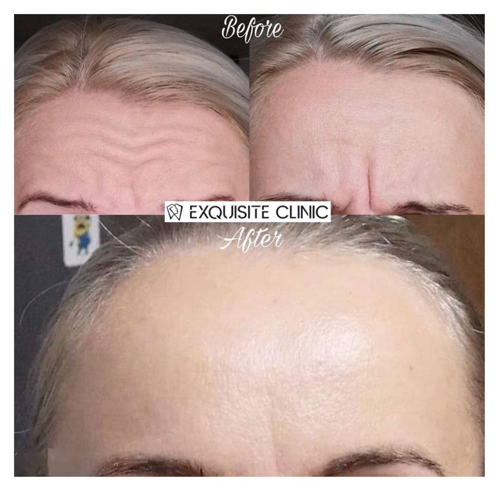 Clinica Stomatologica Cluj-Napoca - Manastur | EXQ Clinic